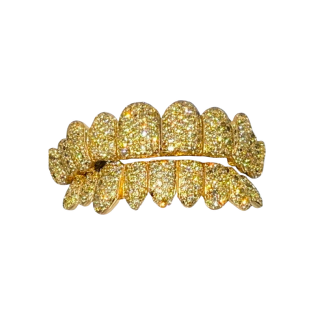 Custom Canary Hand Set Diamond Grillz (Zigzag setting) – VVS Grillz