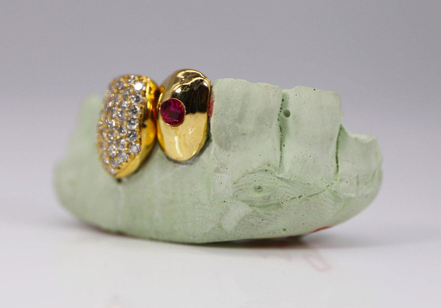 Diamond and Ruby Grillz – VVS Grillz